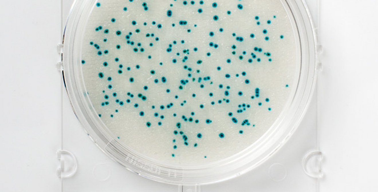 Compact Dry CF (en) - Food & Feed Analysis