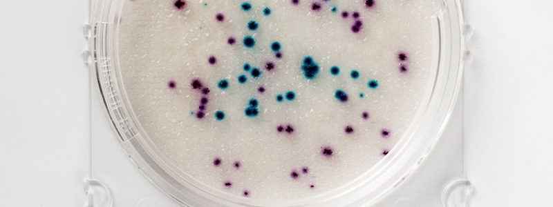 Coliforme Bakterien - Food & Feed Analysis