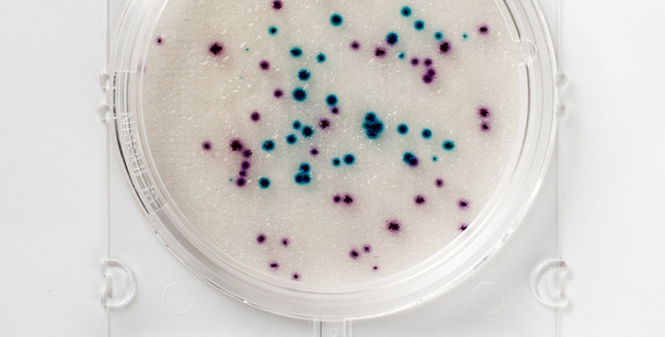 Compact Dry CF (en) - Food & Feed Analysis