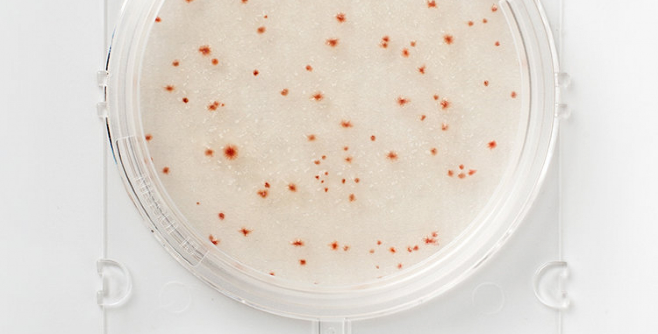 Compact Dry AQ (en) - Food & Feed Analysis