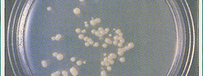 Hefen & Schimmelpilze - Food & Feed Analysis